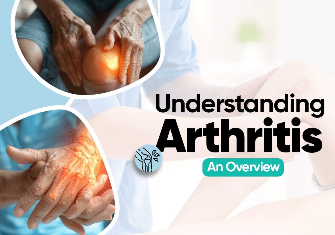 Understanding Arthritis: An Overview - Sanjeevni Plus Hospital